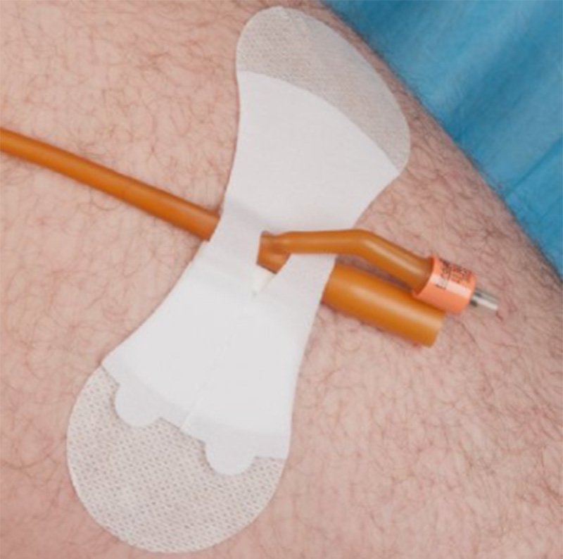 Grip Lok Large Non-Sterile - Health7